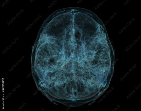 Human Skull Brain By Ct Scan X Ray Visualization Inside Of Skull 3d