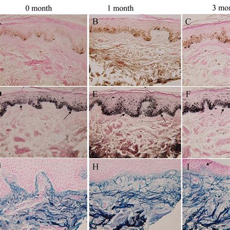 The Number Of Epidermal Melanocytes And Melanoblasts Of Normal Human
