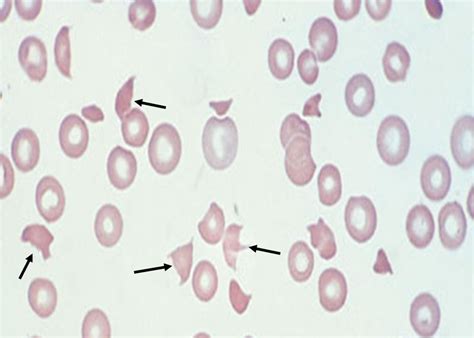 Diagnóstico por imagen Patología Médica III