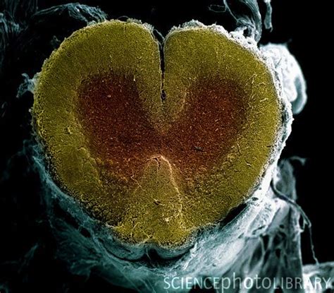 spinal cord coloured scanning electron micrograph sem of a cross