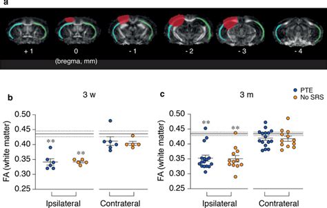 White Matter Integrity In Mice With And Without Spontaneous Seizures