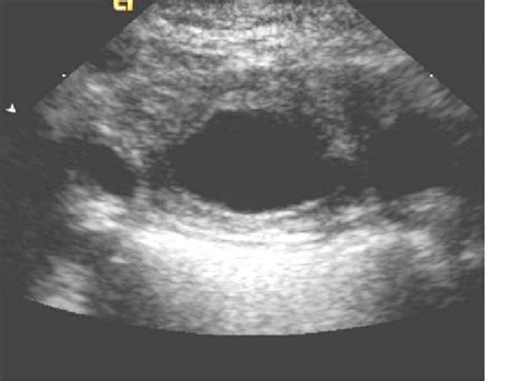 Showing Percentage Of Us Findings In The Urinary Tract Download Scientific Diagram