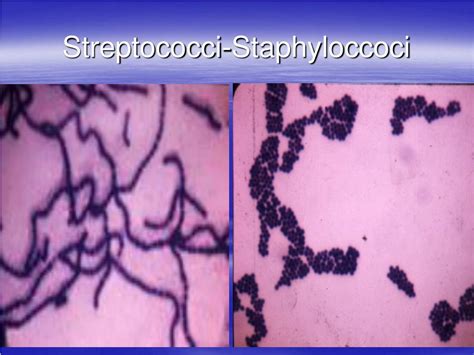 Ppt Infective Endocarditis Powerpoint Presentation Free Download Id 3301876