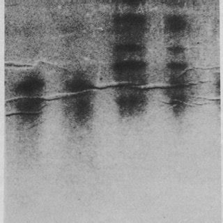 Proteolytic digestion patterns of α and β tubulin subunits from catfish Download Scientific