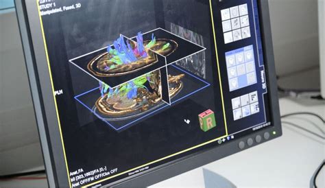 Bari Inaugurati Nuovi Spazi E Risonanza Magnetica Allospedale San
