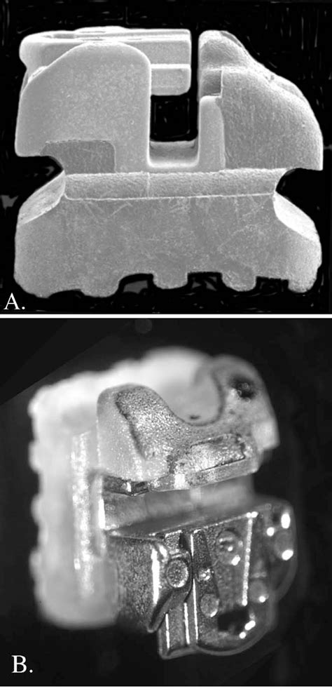 Figure 2 From Self Ligation Esthetic Brackets With Low Frictional Resistance Semantic Scholar