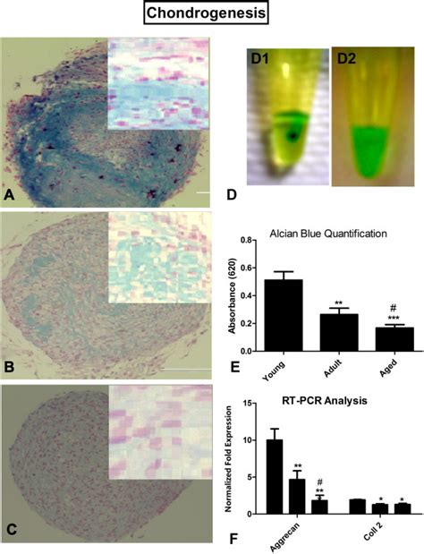 Chondrogenic Potential Of At Mscs Is Compromised By Donor Age
