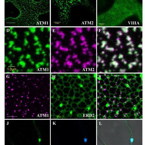 Subcellular Localization Of Myosin Viii In Abaxial Leaf Epidermis Cells Download Scientific