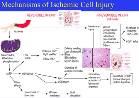 Cell Injury And Necrosis Flashcards Quizlet