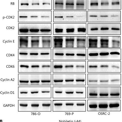 The Effects Of Nobiletin On The Expression Of Cell Cycle Regulatory