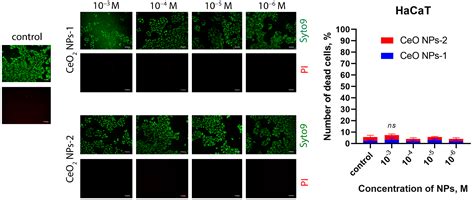 IJMS Free Full Text Influence Of The Synthesis Scheme Of