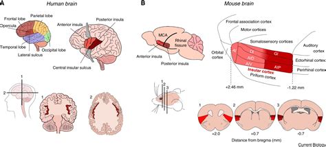 The Insular Cortex Current Biology