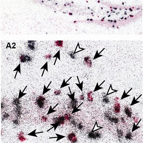 The Cre Recombinase In Dlx5 6 Cre Ai9 Mice Activates Reporter Gene Download Scientific Diagram