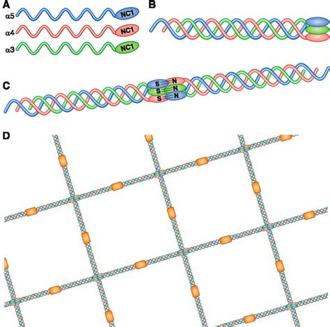 Figure 1 From Anti Glomerular Basement Membrane Disease Semantic Scholar