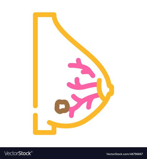 Lobular Breast Cancer Color Icon Royalty Free Vector Image