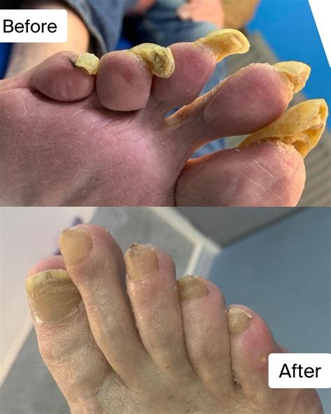 Get Your Feet Summer Ready In The Happy Feet At Home