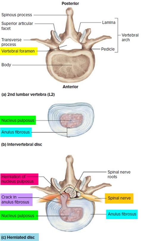 Intervertebral Disc Anatomy Function Degeneration Herniation
