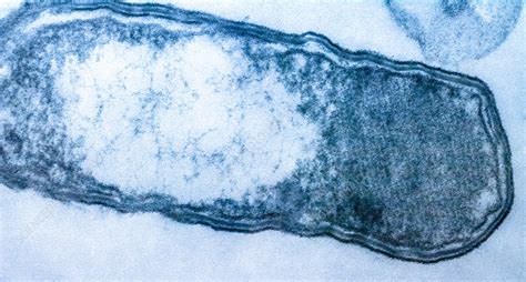 Clostridium Botulinum Bacteria Tem Stock Image C050 3958 Science Photo Library