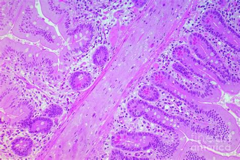 Jejunum Photograph By Steve Gschmeissner Science Photo Library Pixels