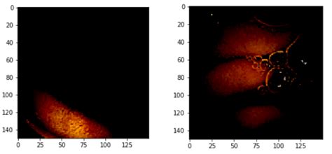 Annotating The Red Lesions In Capsule Endoscopy Images Download Scientific Diagram