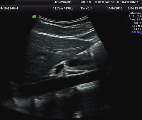 Meet Joey Luna Voyagephoenix Phoenix