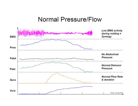 Urodynamics And Neuro Urology Urology Malaysia