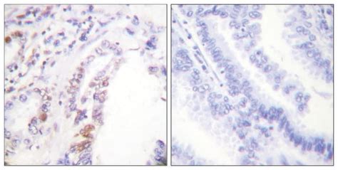 runx1 sigma aldrich