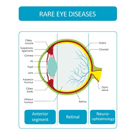 Rare Diseases Covered By Ern Eye Ern Eye