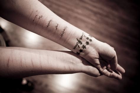 My Great Depression Scars
