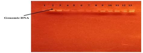 Genomic Dna Extracted From E Coli Isolates After Electrophoresis On