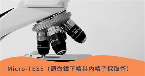 無精子症とは？【原因・対策・検査方法を専門医が徹底解説】 Sugucare スグケア