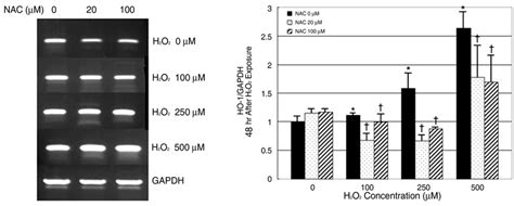 Rt Pcr Results Of Ho 1 Mrna Expression In 48 Hours Culture Human