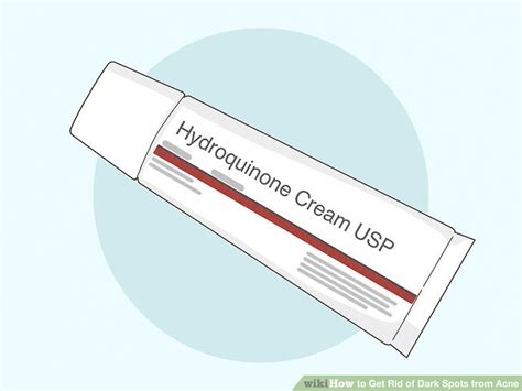 How To Get Rid Of Dark Spots From Acne 8 Steps With Pictures