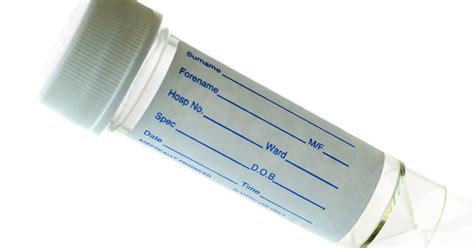 Ruths Lockdown Project Home Msu Test Kit Ms Trust