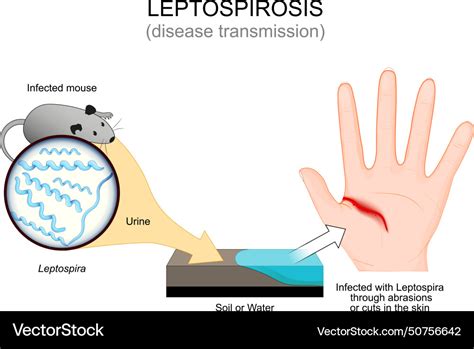 Leptospirosis Disease Transmission From Infected Vector Image