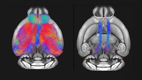 Prefrontal Mis Wiring [image] Eurekalert Science News Releases