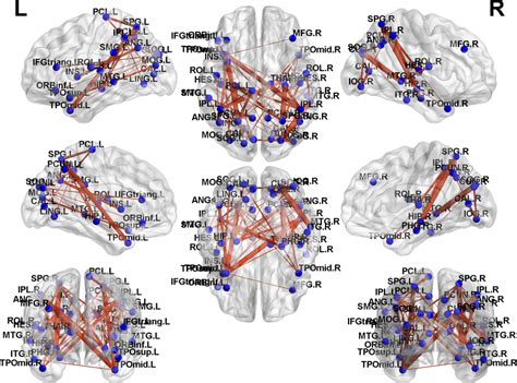 Connected Networks That Show Increased Functional Connections In The Download Scientific