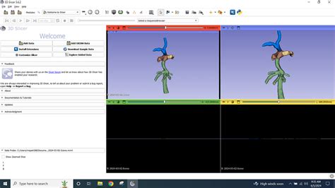 Error In Opening Files Using Slicer 562 Development 3d Slicer Community