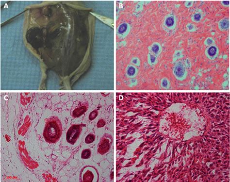 Teratoma Formation Teratoma Formation In Immunodeficient Mice