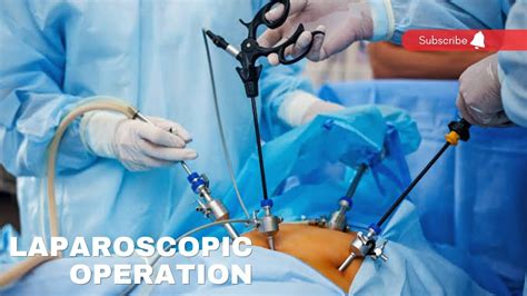 Laparoscopic Cholecystectomy Operation Youtube