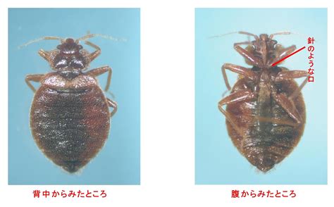 トコジラミやばい 【閲覧注意】 むきりょく日記