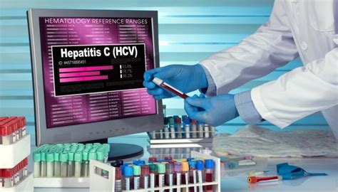 ما هي أنواع تحليل فيروس سي Hcv وهل يجب الصيام قبل الفحص؟