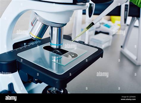 Microscopic Urinalysis Research Of Urine Test Sample Under Medical