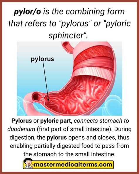 Pyloro Master Medical Terms