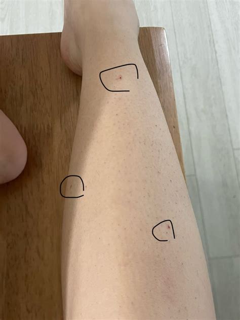 수염면도기로 다리털 밀고 지식in