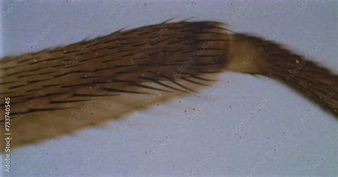 Housefly Leg Under Microscope And Vhs Filter Microscopic Insect
