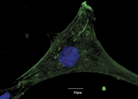 Primary Human Osteoblast Hob Cells Growing On A Bioactive Glass