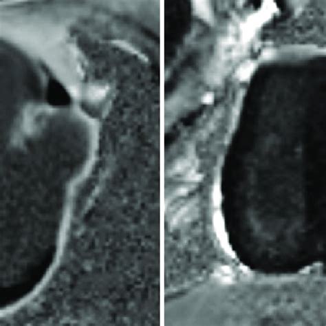Cardiac Magnetic Resonance Imaging Download Scientific Diagram