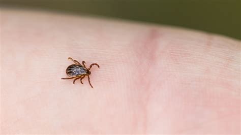 Potentially Deadly Tick Borne Parasite Found In Uk For The First Time