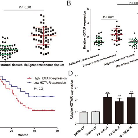 Hotair Levels Are Elevated In Melanoma And Association With Poor